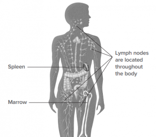 lymphoma: Types, Symptoms, Diagnosis and Treatments